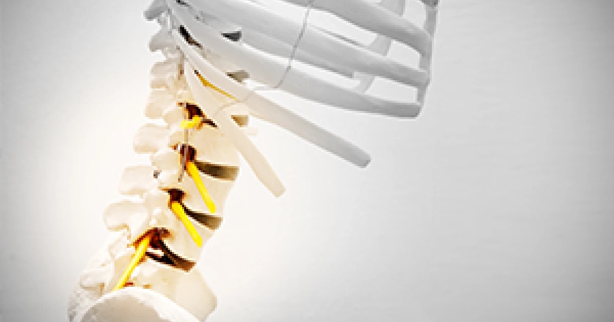 Punctia lombara - Alphega